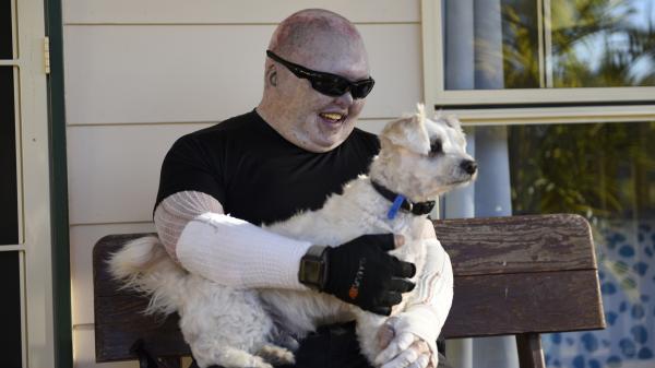 Little Dany's First Smile | Body Bizarre | Videos | discovery+