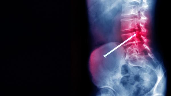 Body Invaders | Shows | discovery+